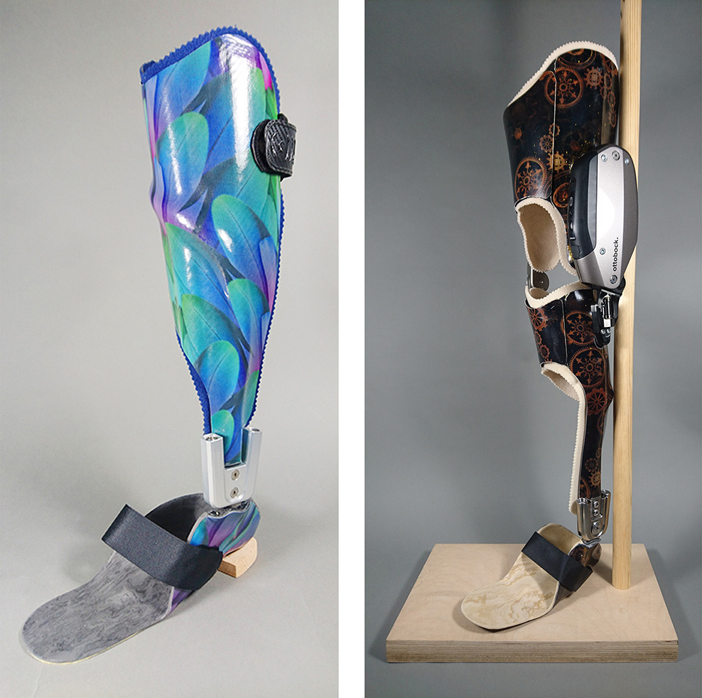 Maßorthesen-Handwerk von Ihrem Sanitätshaus OrthoTec Lindlar